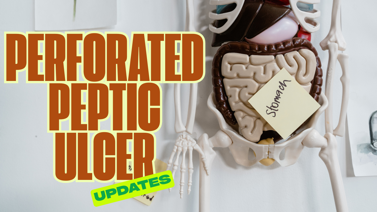 Perforated peptic ulcer- Silent Killer in the Gut | Prescription Crackers