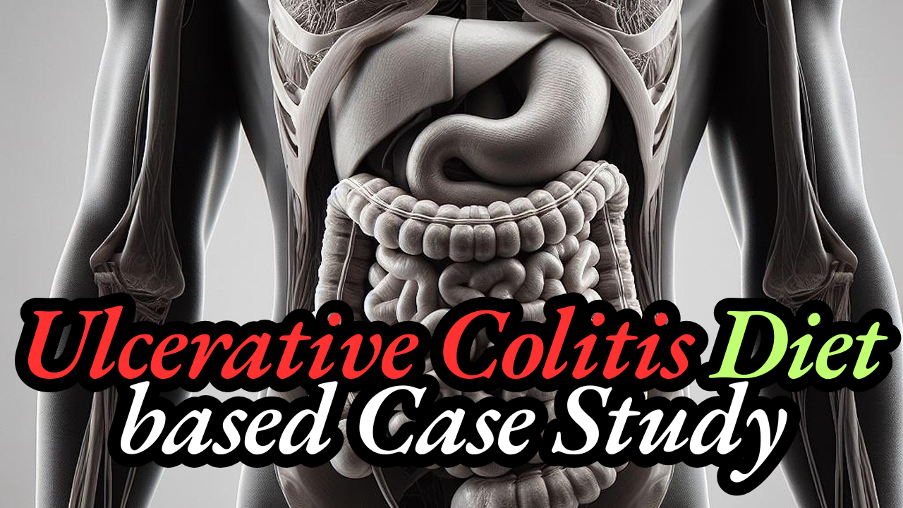 Ulcerative Colitis Diet based Case Study: Role of Fecal Calprotectin ...